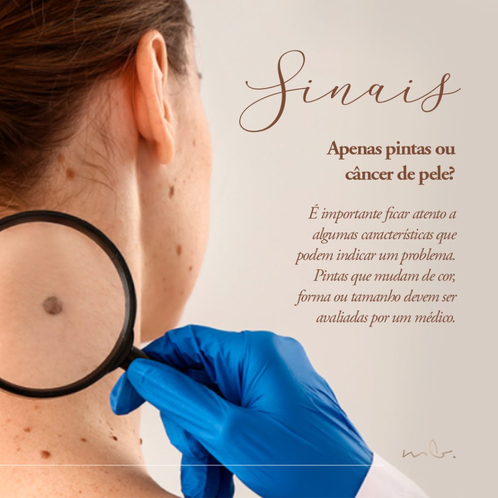 Dra Melissa Bristot - Dermatologista | Apenas um sinal (pinta) ou ...
